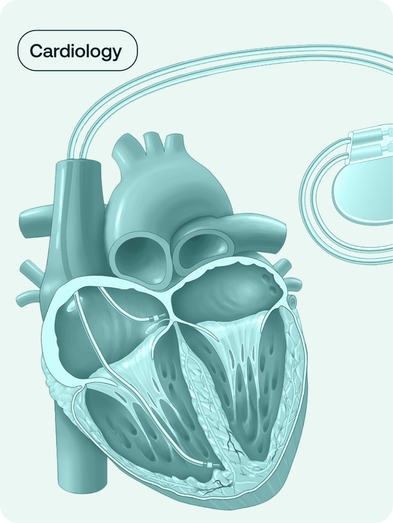 Ein modulares kommunikatives „leadless pacing" Schrittmacher ...