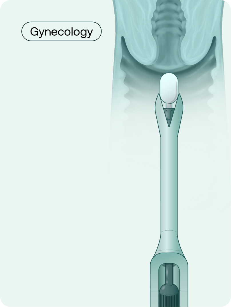 Self-collected vaginal samples for cervical cancer screening - Medudy